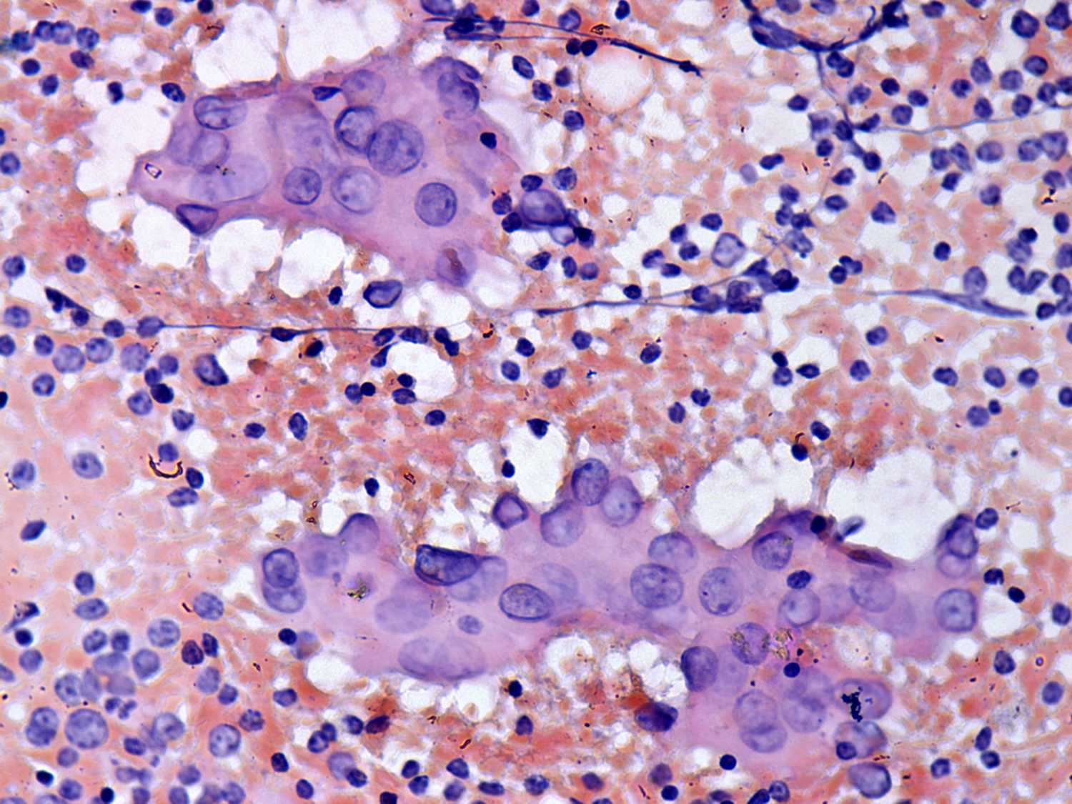 Course Cytological Differential Diagnotics Of Atypia In Hahsimoto s course-cytological-differential-diagnotics-of-atypia-in-hahsimoto-s